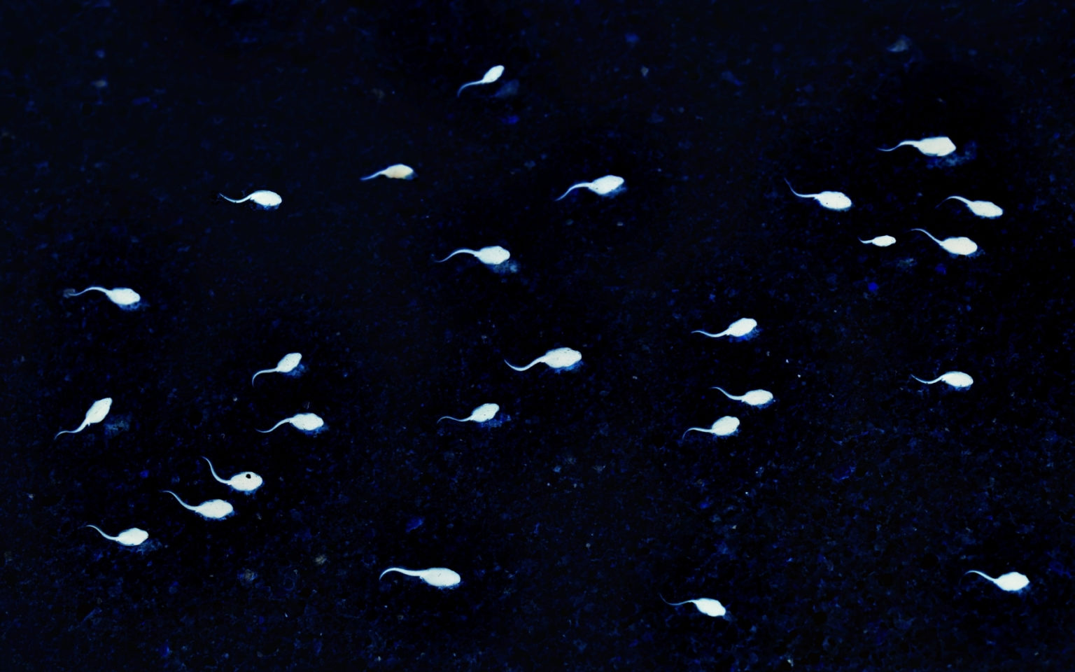 Azoospermia - Jonathan Ramsay - Male Fertility Specialist